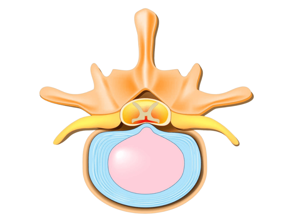Spinal Decompression - Vizuri Health